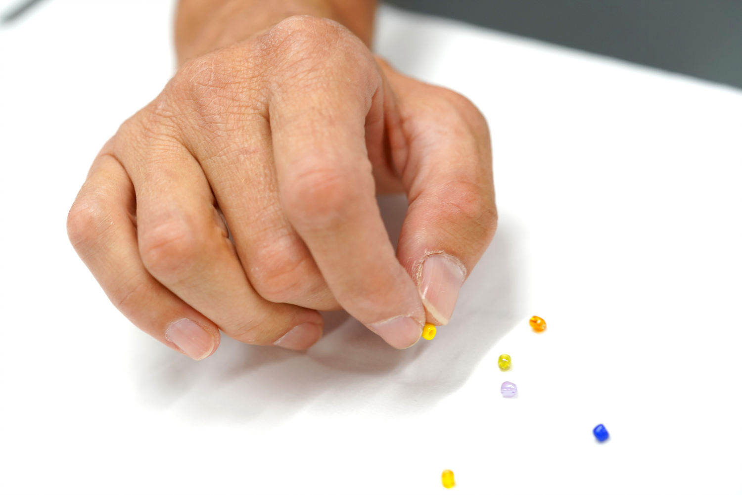 New treatment allows some people with spinal cord injury to regain hand ...